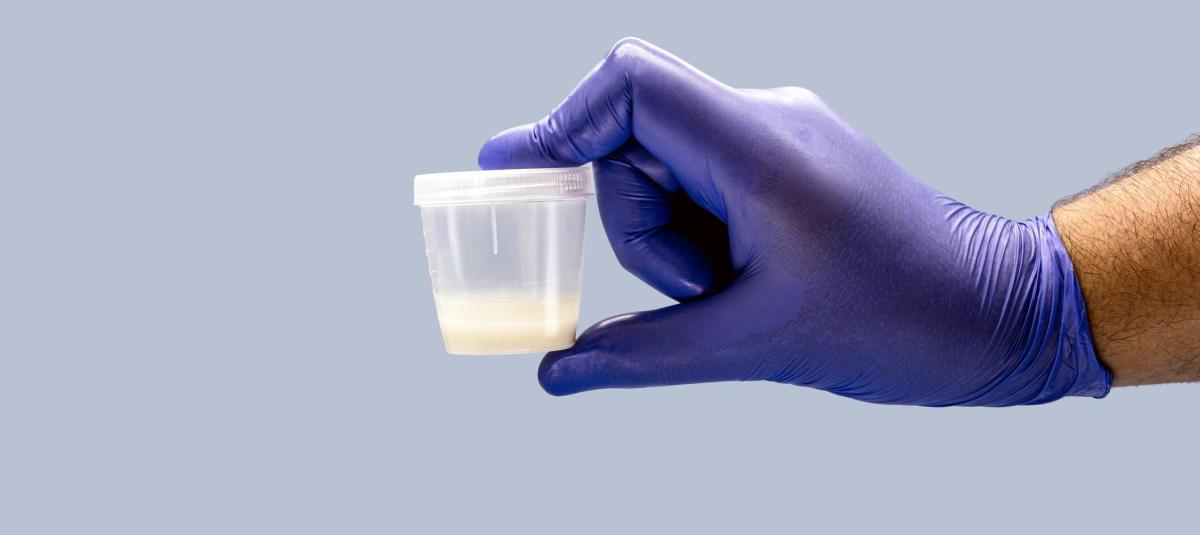 Alimentos que ayudan a producir esperma: la dieta que mejora la calidad ...