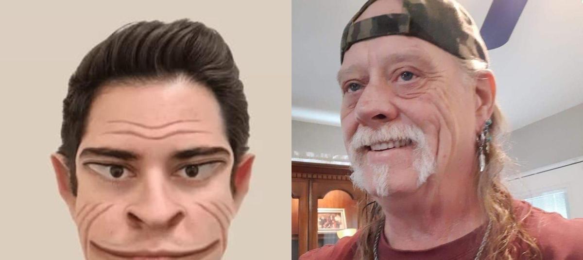 Este hombre es una de las 100 personas en el mundo con el 'síndrome de ...