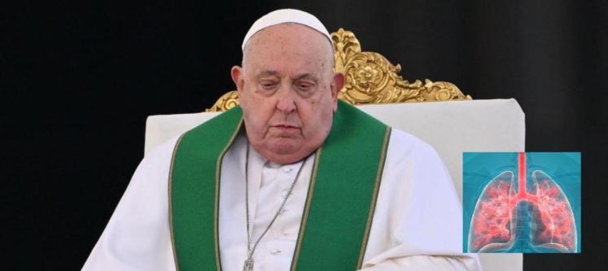 Síntomas y signos de alerta de la neumonía bilateral, enfermedad que padece el papa Francisco