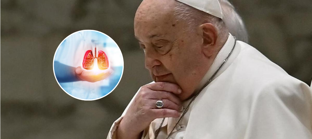 Salud del papa Francisco | ¿Qué es la bronquiectasia y cómo afecta recuperación tras últimas ...