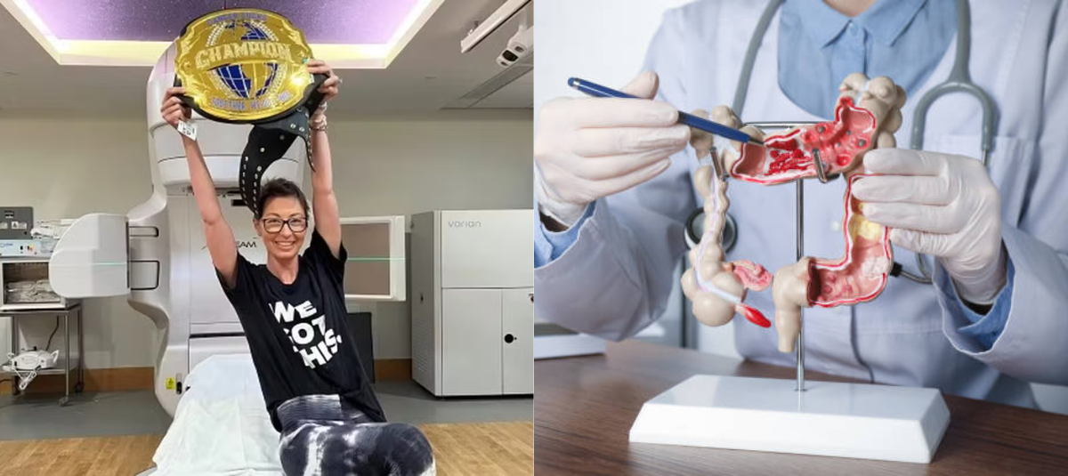 Mujer de 34 años fue diagnosticada con cáncer de colon en etapa 3: los ...