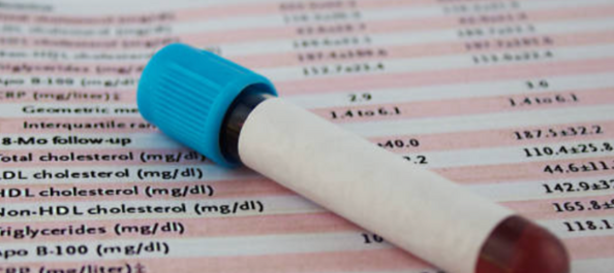 ¿Cuándo se considera que los niveles de colesterol están muy altos? Esto es lo que debe saber