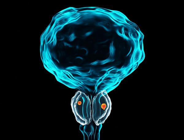 ¿De qué tamaño es una próstata saludable y en qué casos es necesario ir ...