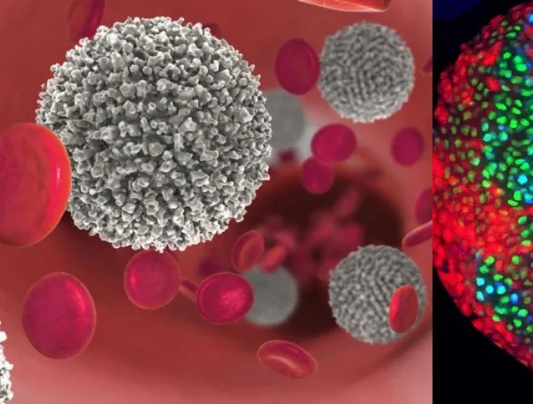 El cáncer que afecta principalmente a adultos mayores y crece en ...