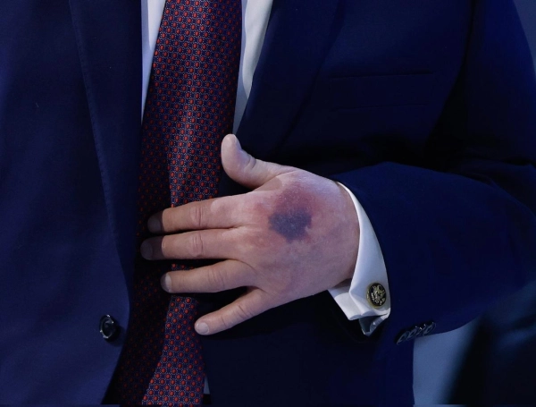 El estado físico y mental del presidente de EE. UU., Donald Trump, bajo ...