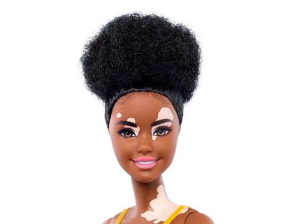 Barbie lanza nueva colección de muñecas con vitiligio y sin pelo