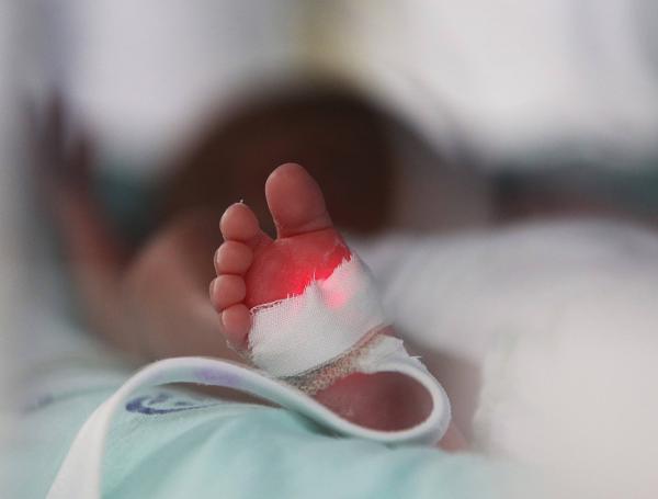 Brasil: nació bebé con una cola de 12 centímetros