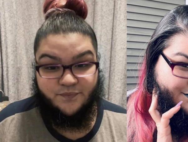 Mujer se deja crecer la barba y la luce con orgullo