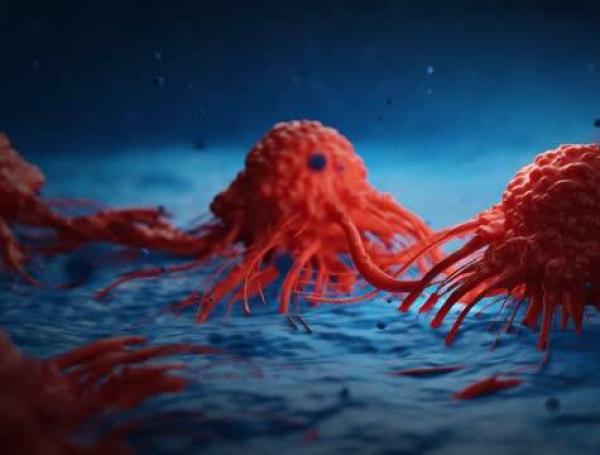 El cáncer que afecta principalmente a adultos mayores y crece en ...