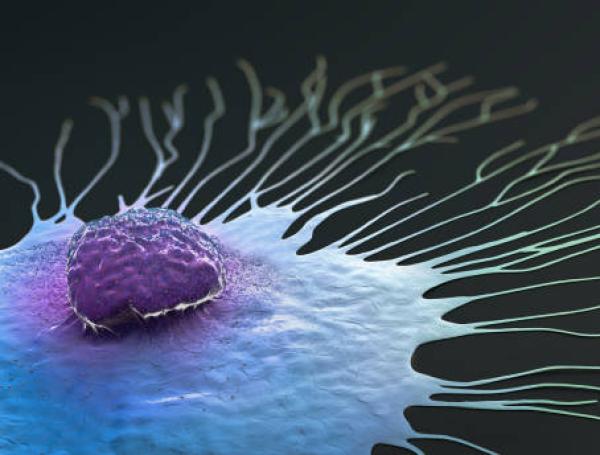 ¿Se puede curar un cáncer con metástasis? La ciencia ha avanzado y ...