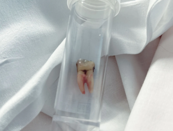 Hombre hacía chistes sobre el tamaño de su papada, pero descubrió grave ...