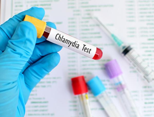 Clamidia, la infección de transmisión sexual que ataca sin síntomas y ...