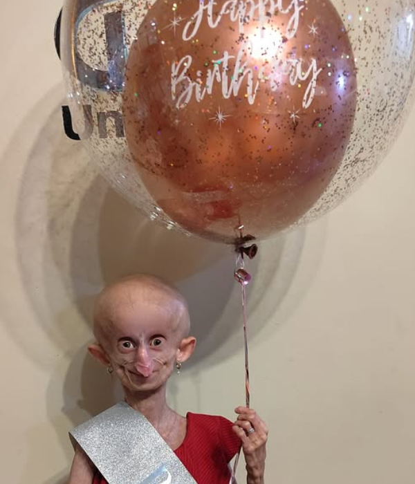 Muere Beandri Booysen, la 'tiktoker' de 19 años que luchaba contra una ...