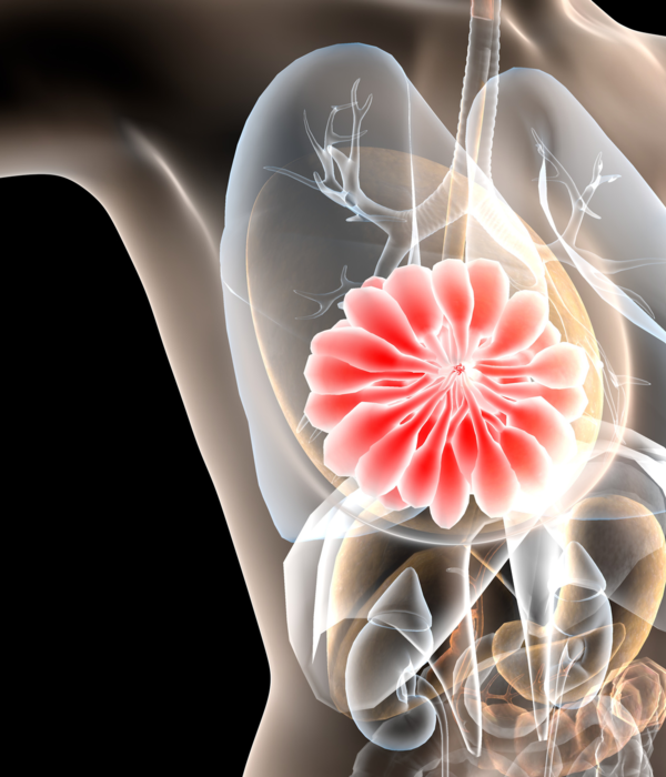 Cáncer de mama: Wilson Cubides habla de factores de riesgo y señales de ...