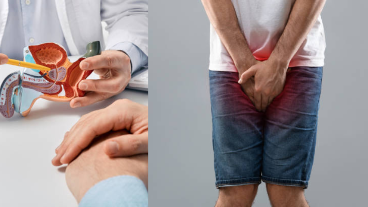 Stilvolle Vergrsserte Prostata Ursachen Fotos