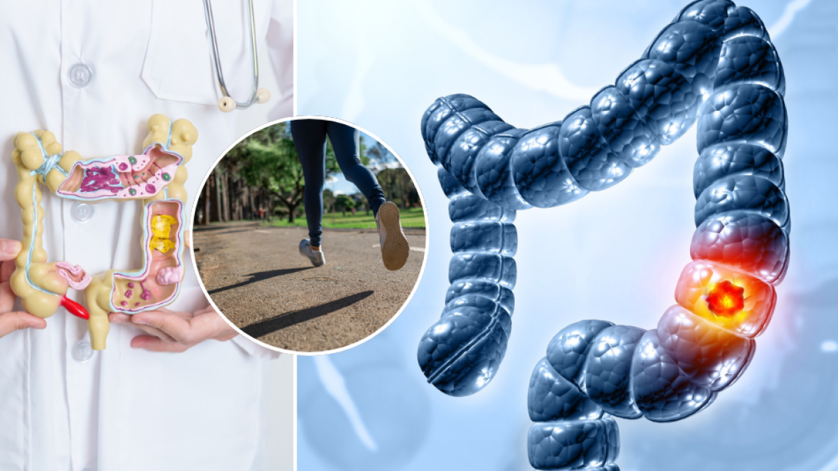 Este hábito ayudaría a sobrevivientes de cáncer de colon a vivir tanto ...