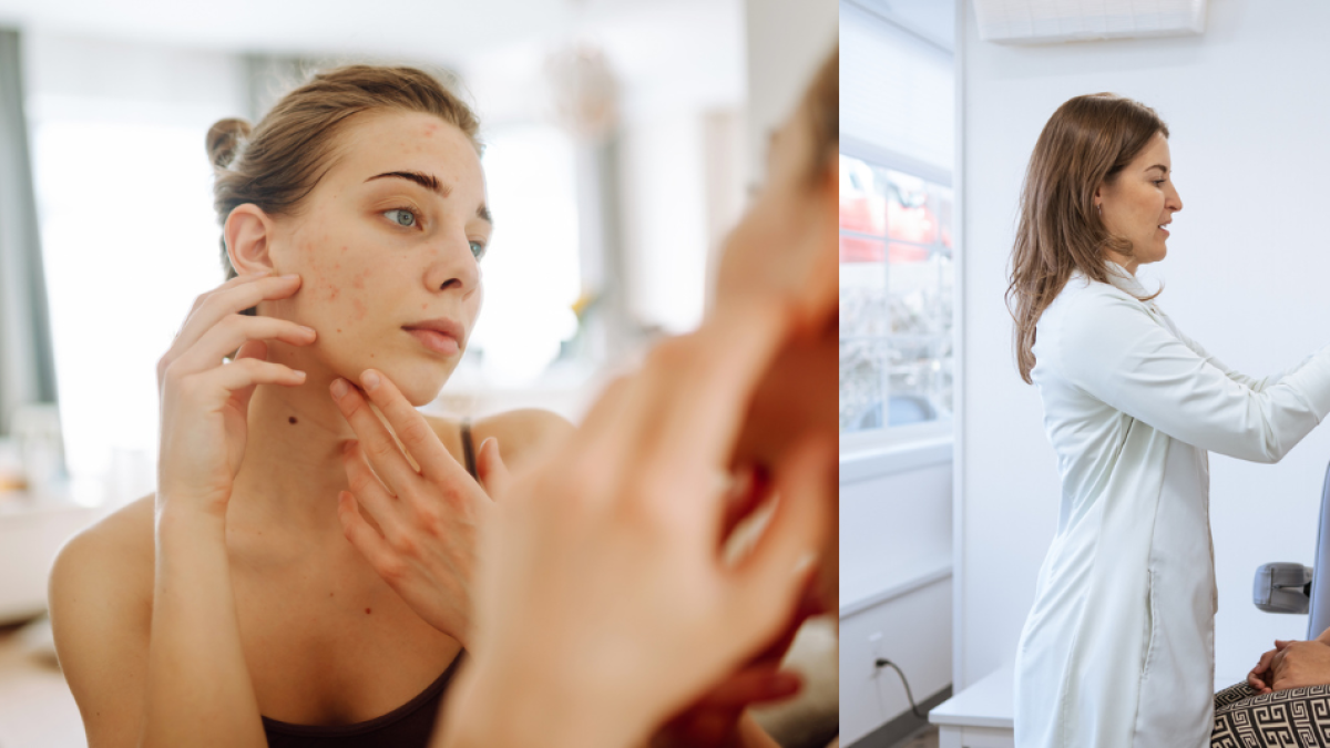 Mujer perdió parte de su mejilla derecha por una mancha solar en la ...