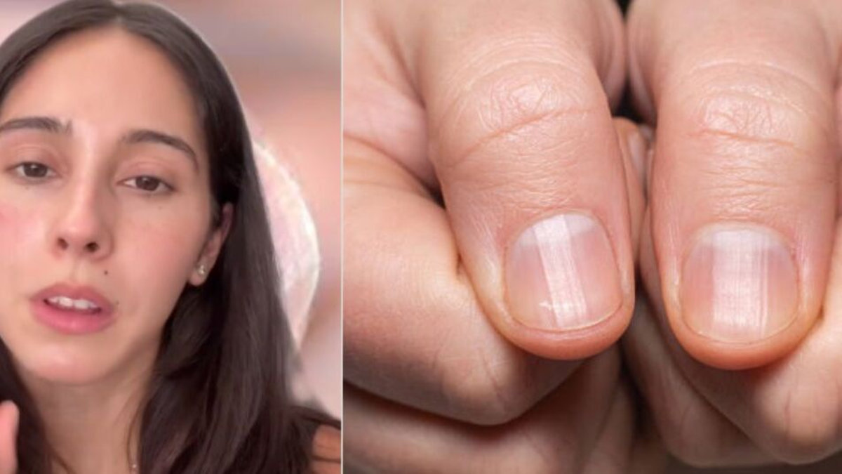 Marcela Alfaro, dermatóloga: ‘Si tienes líneas verticales en las uñas ...