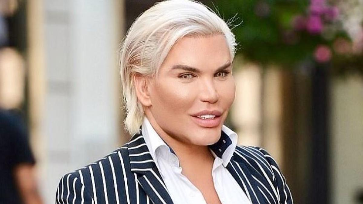 Rodrigo Alves se practicará su 60 cirugía para quitarse costillas y ...