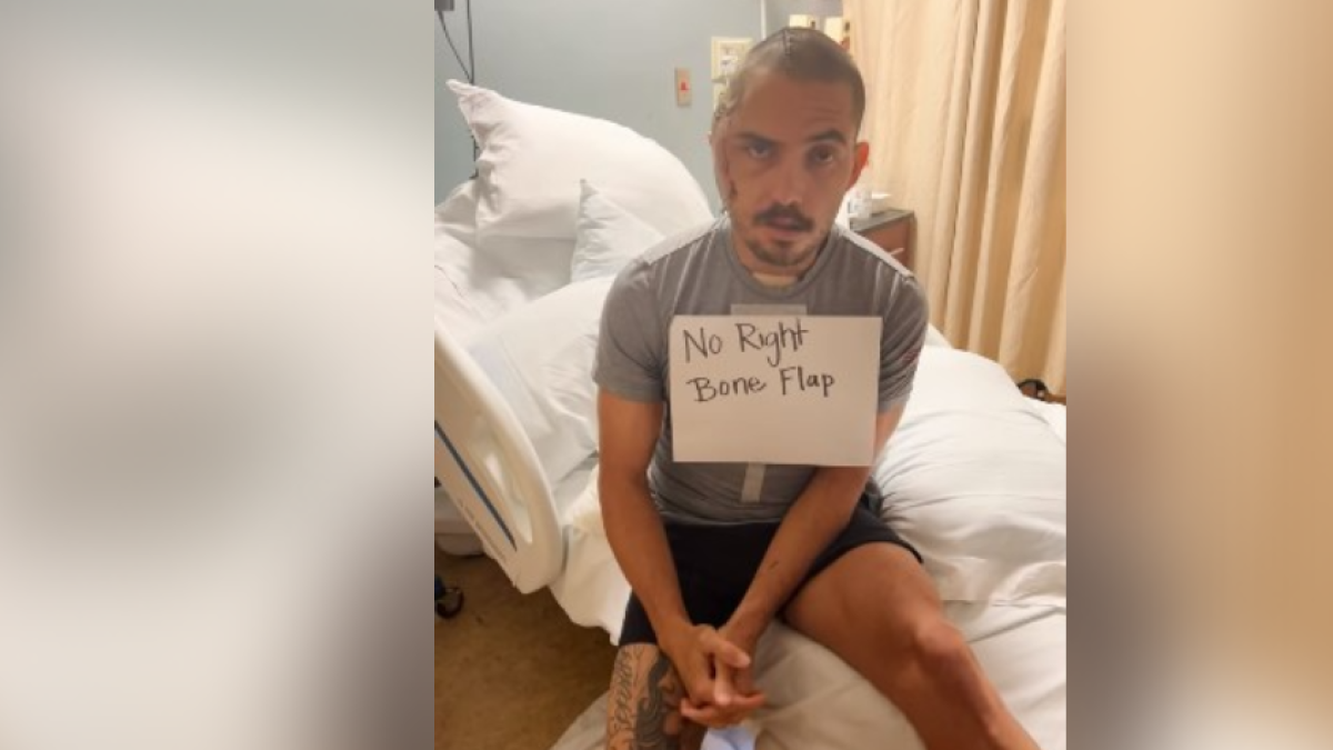 Colombiano es atacado por caimán en la Florida