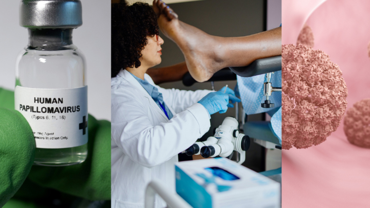 VPH: la enfermedad de transmisión sexual que puede generar cáncer