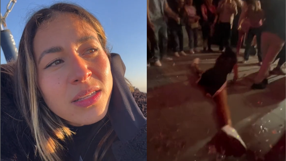 Mujer se vuelve viral por causarse fuerte lesión por ‘perrear’