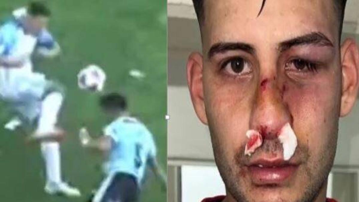 Video: Juan Pacchini recibió esta patada y se fracturó la nariz ...