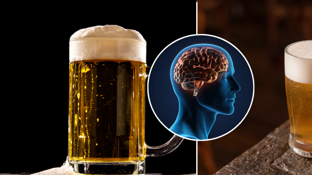 Así está dañando su cerebro por consumir alcohol en exceso aunque sea ...