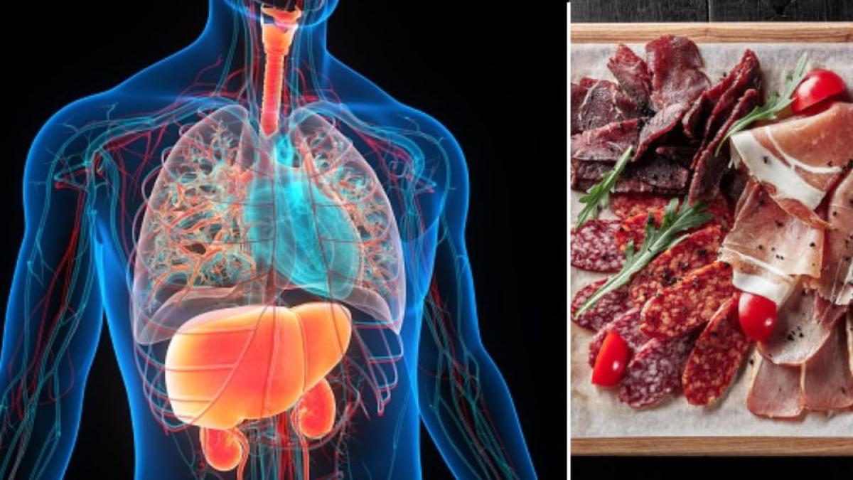 Riesgos de comer salchicha, jamón y otros embutidos si tiene hígado ...