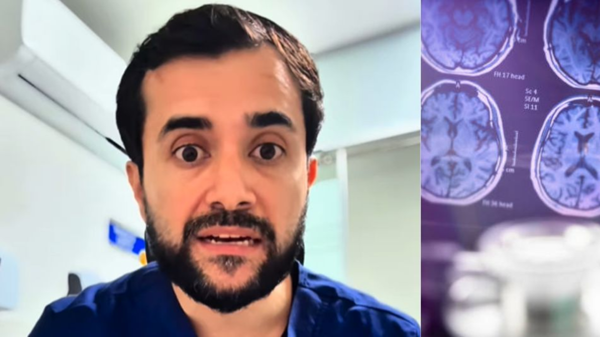 Leonardo Bello, neurólogo: ‘Para mí, el síntoma inicial de Alzheimer es ...