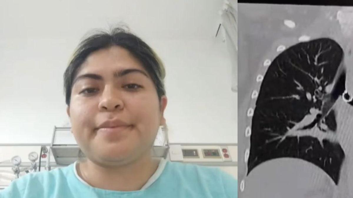 Se abrió un piercing en la nariz y tuvo que ser operada de urgencias ...