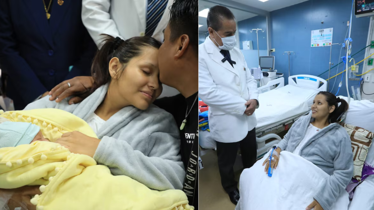 Bebé nació sano tras gestarse en el hígado de su madre en Perú: este es ...