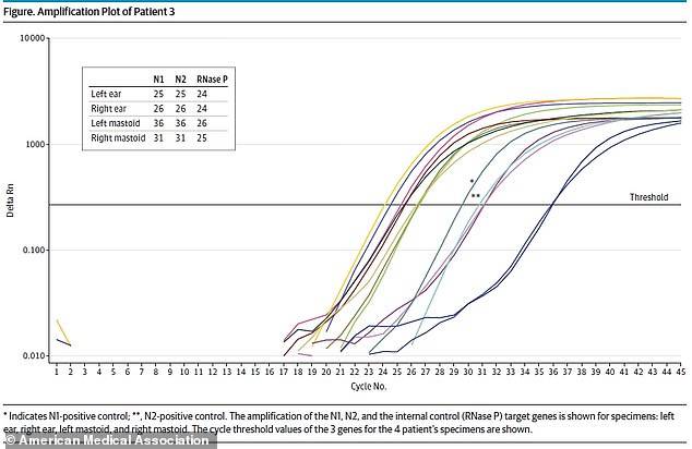 Covid-19: Estudios revelarían que el coronavirus también está en el oído