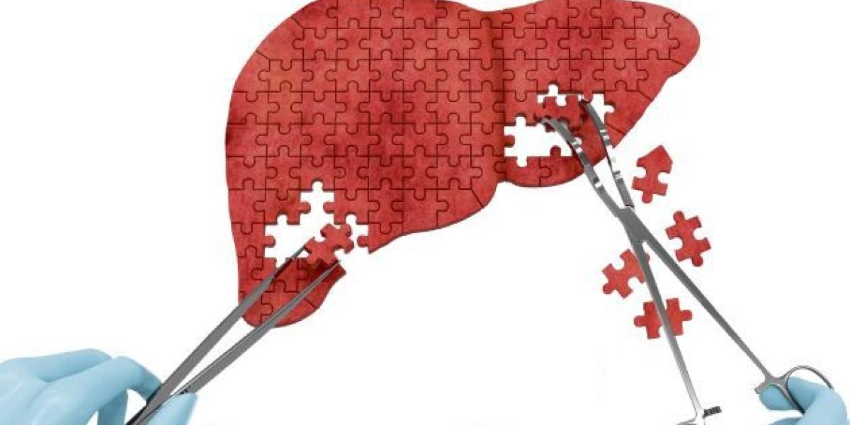 Los cinco tipos de hepatitis, sus síntomas, cómo se transmite y cómo ...