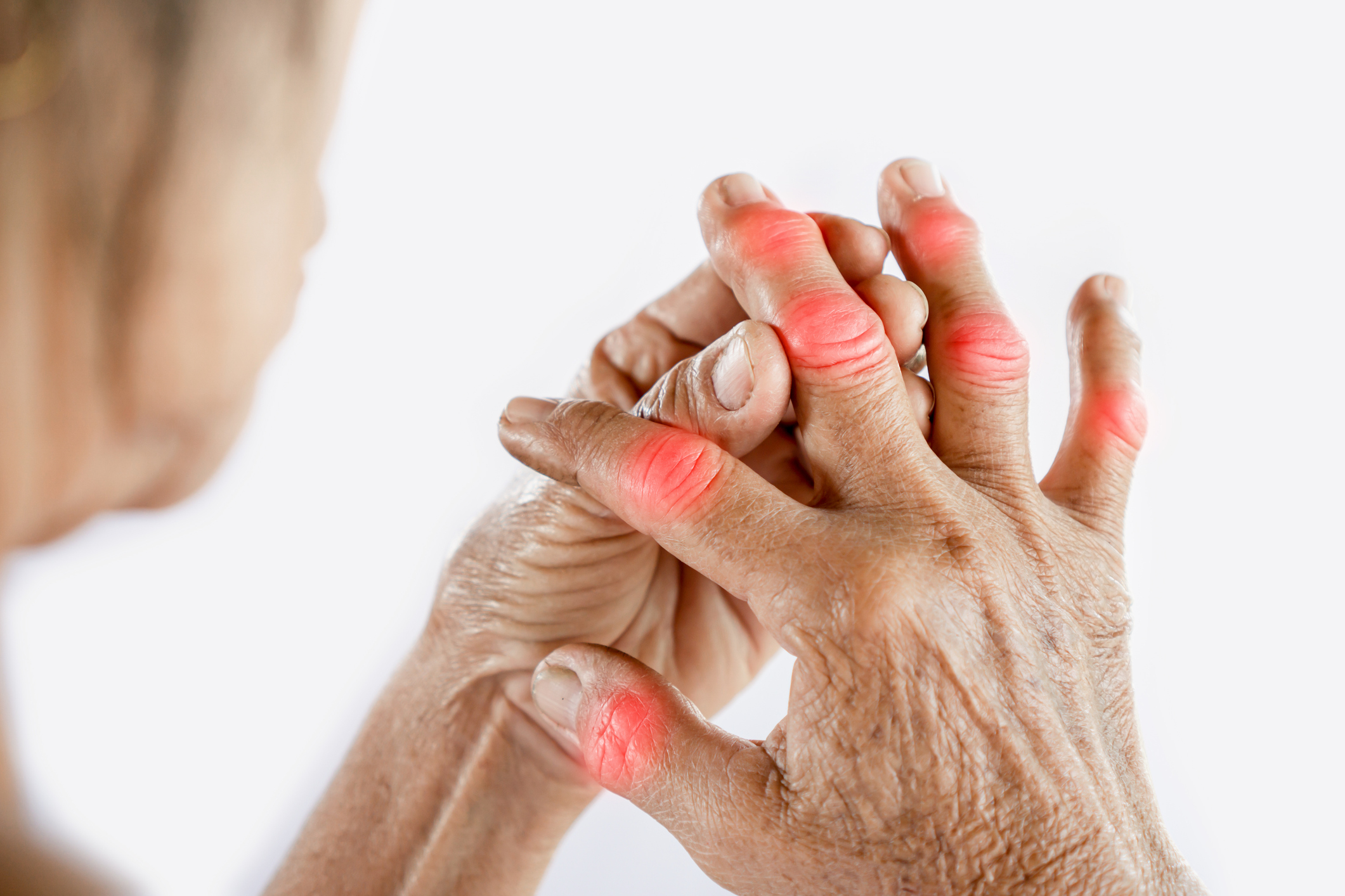 ¿Por qué duelen las manos? Descubra qué puede estar detrás del dolor de ...