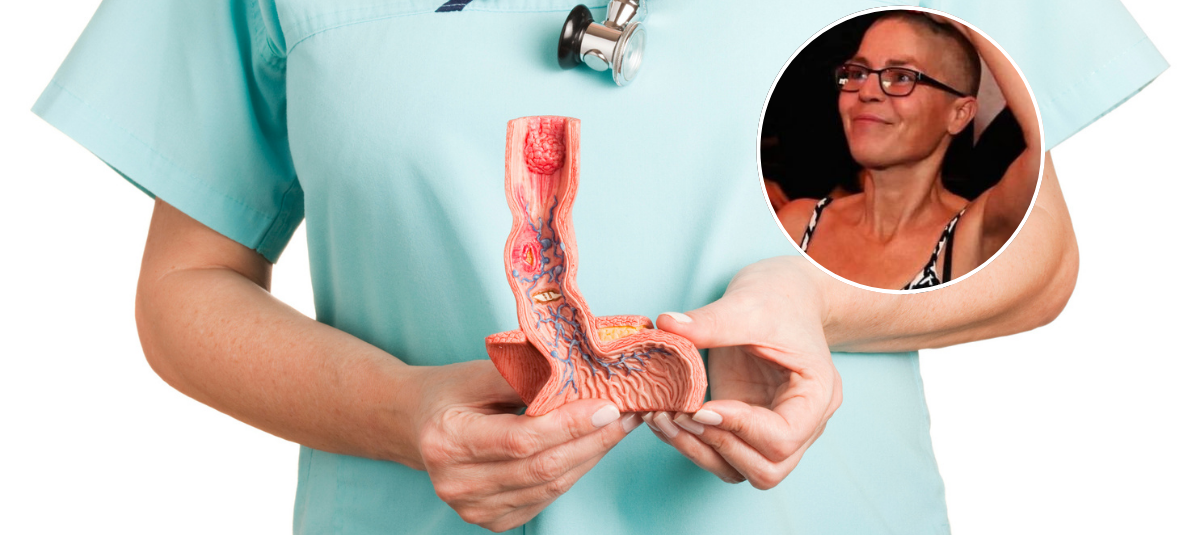 Los doctores dijeron que tenía reflujo, pero en realidad era cáncer de ...