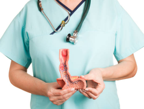 Cirujano digestivo explica cómo prevenir el cáncer de esófago y cuál es ...