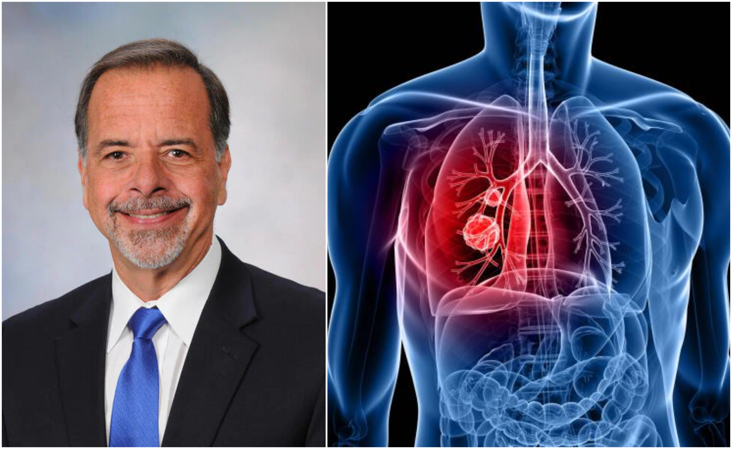 ¿Lleva más de dos meses con tos y, aunque haga de todo, no se va? Estos ...