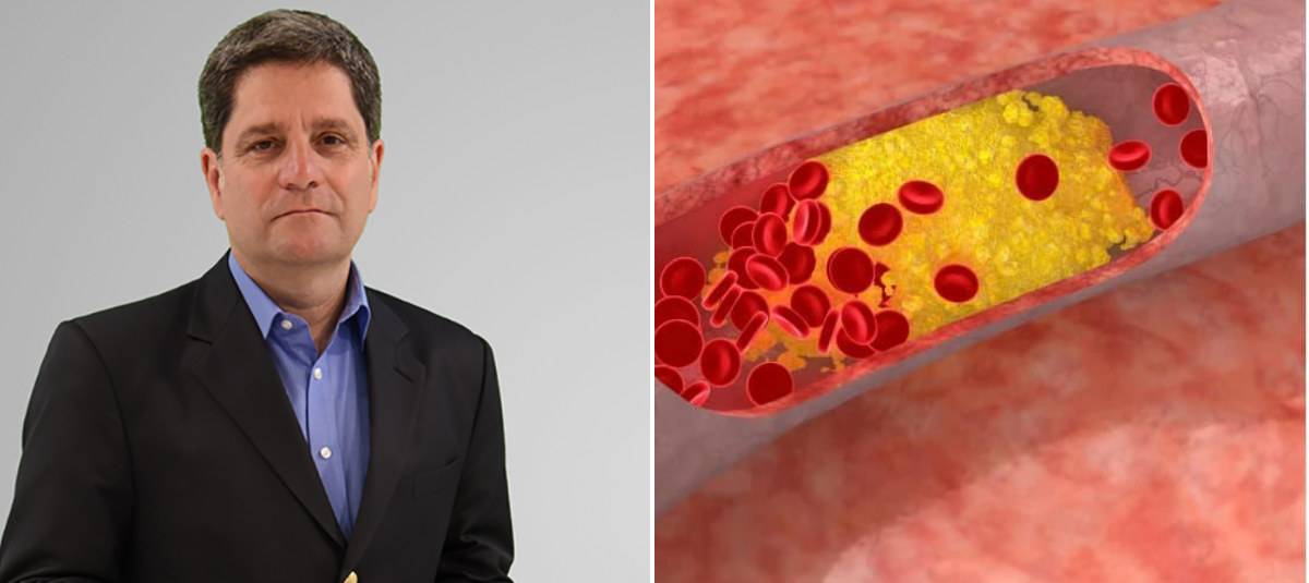 Qué Frutas Debe Consumir Para Bajar El Colesterol