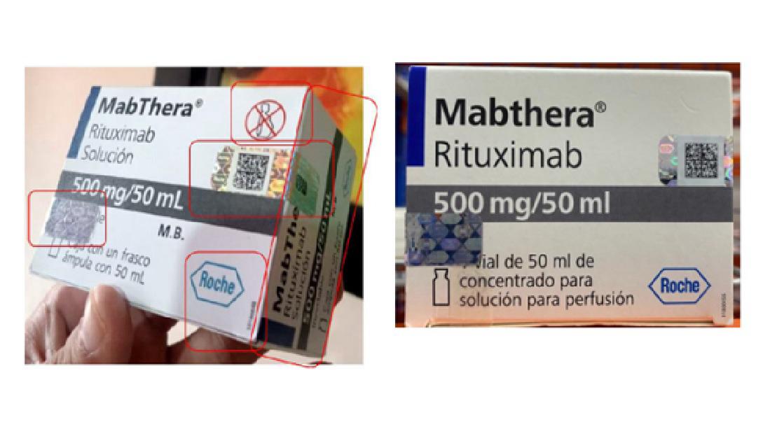 Cómo saber si la tos es por una infección bacteriana: estas son las ...