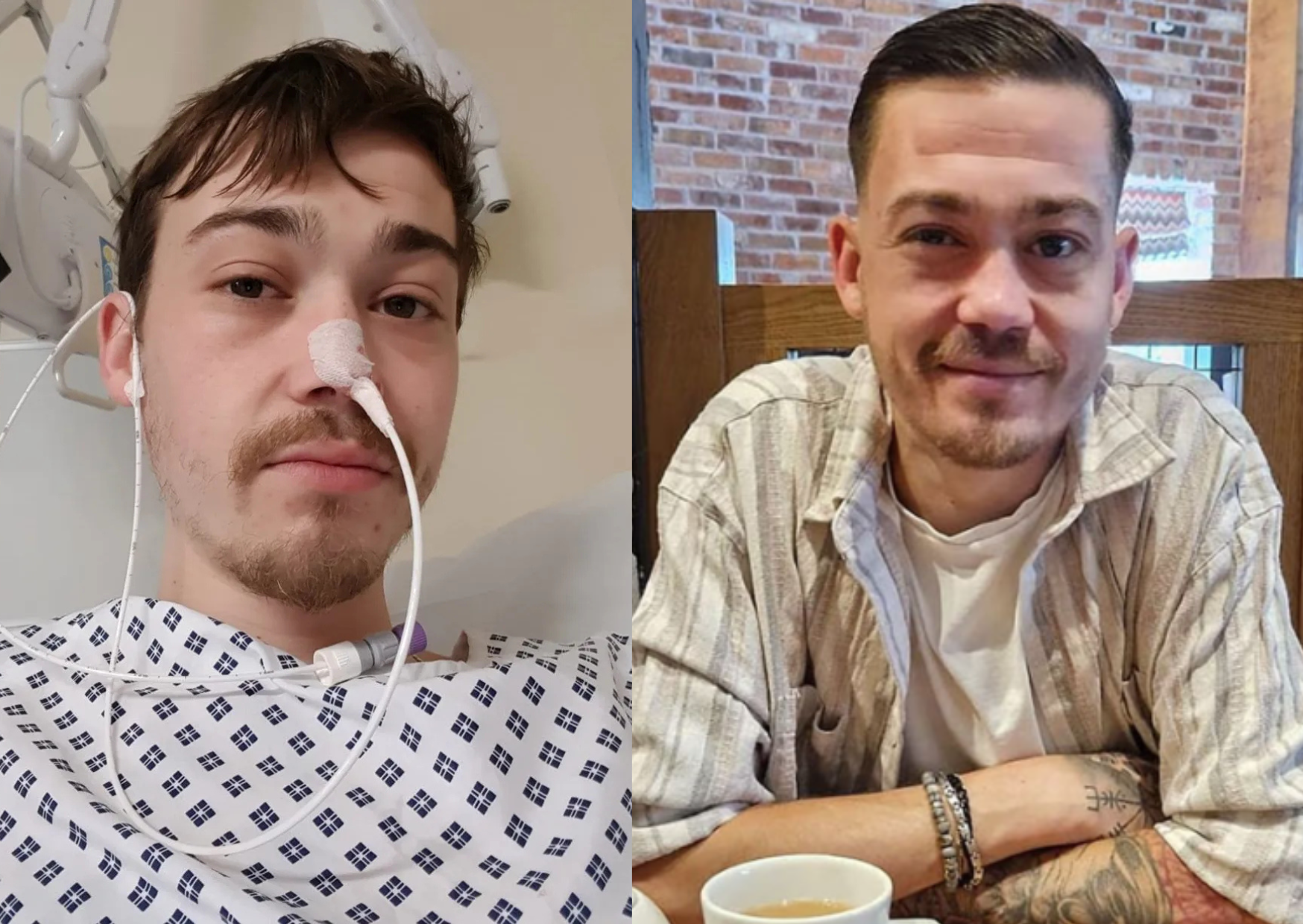 Hombre en Inglaterra fue diagnosticado con rara enfermedad que lo hace ...